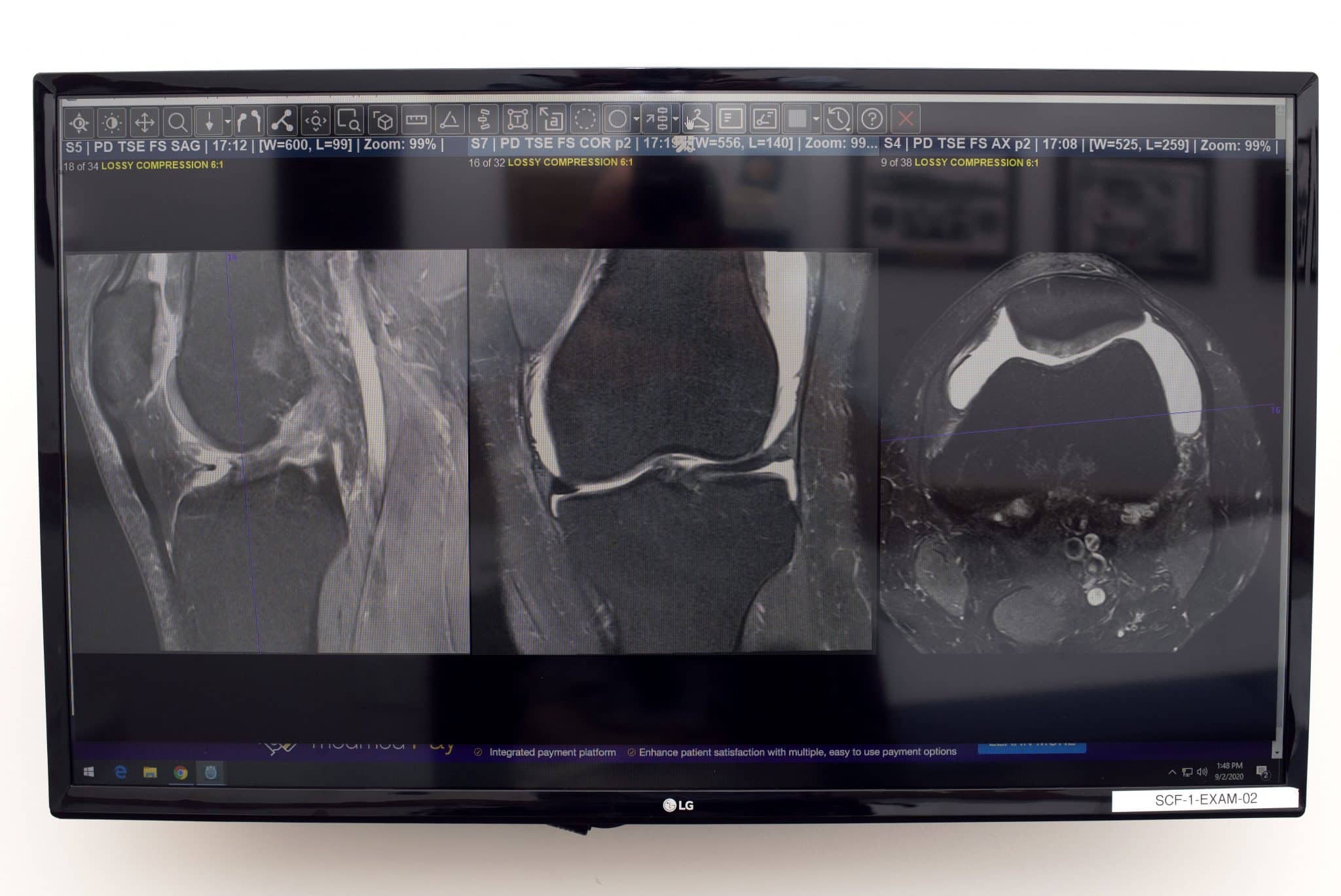 Dr. J. Richard Steadman, pioneering orthopedic surgeon and founder of ...
